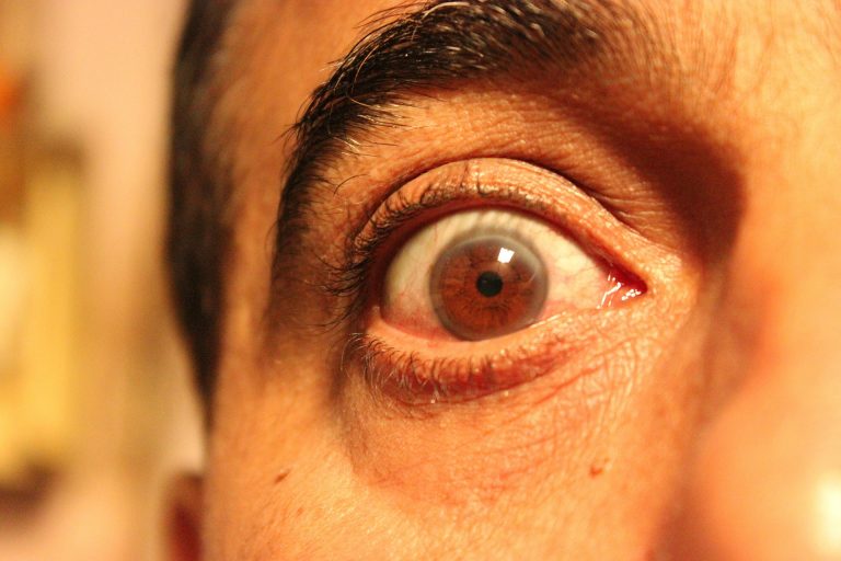 What Happens During Opioid Overdose? | Narcotics.com