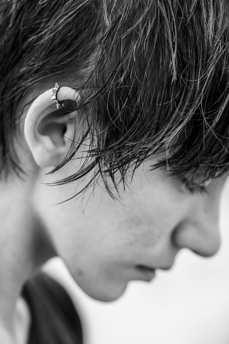 Narcotics Side Effects: Signs & Symptoms of Opioid Misuse