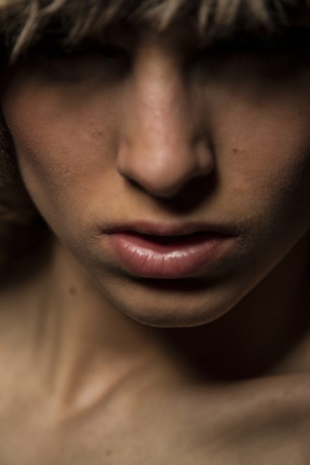 Narcotics Overdose: Signs & Treatment of Opioid Overdose